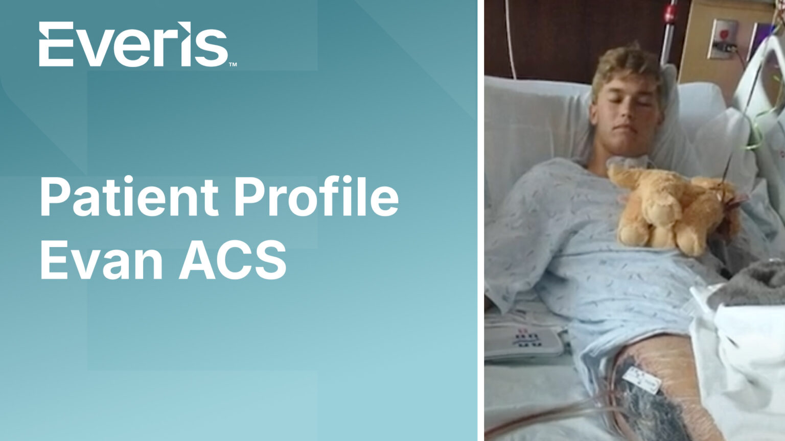 STIC Pressure Monitor | Everis